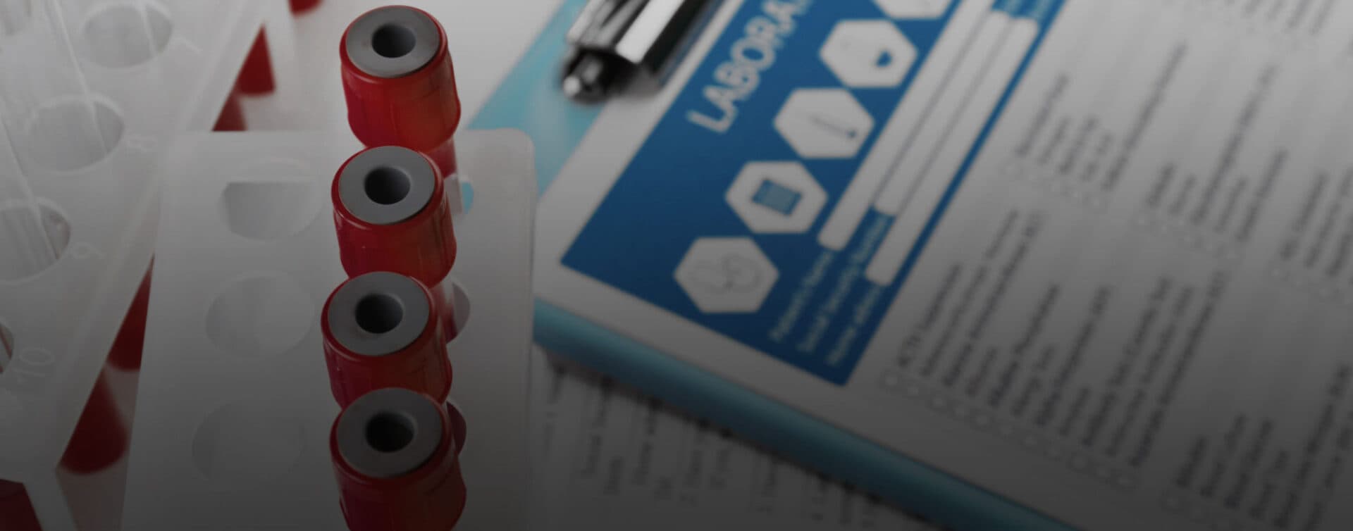 Food Sensitivity Testing - Live Lean Rx